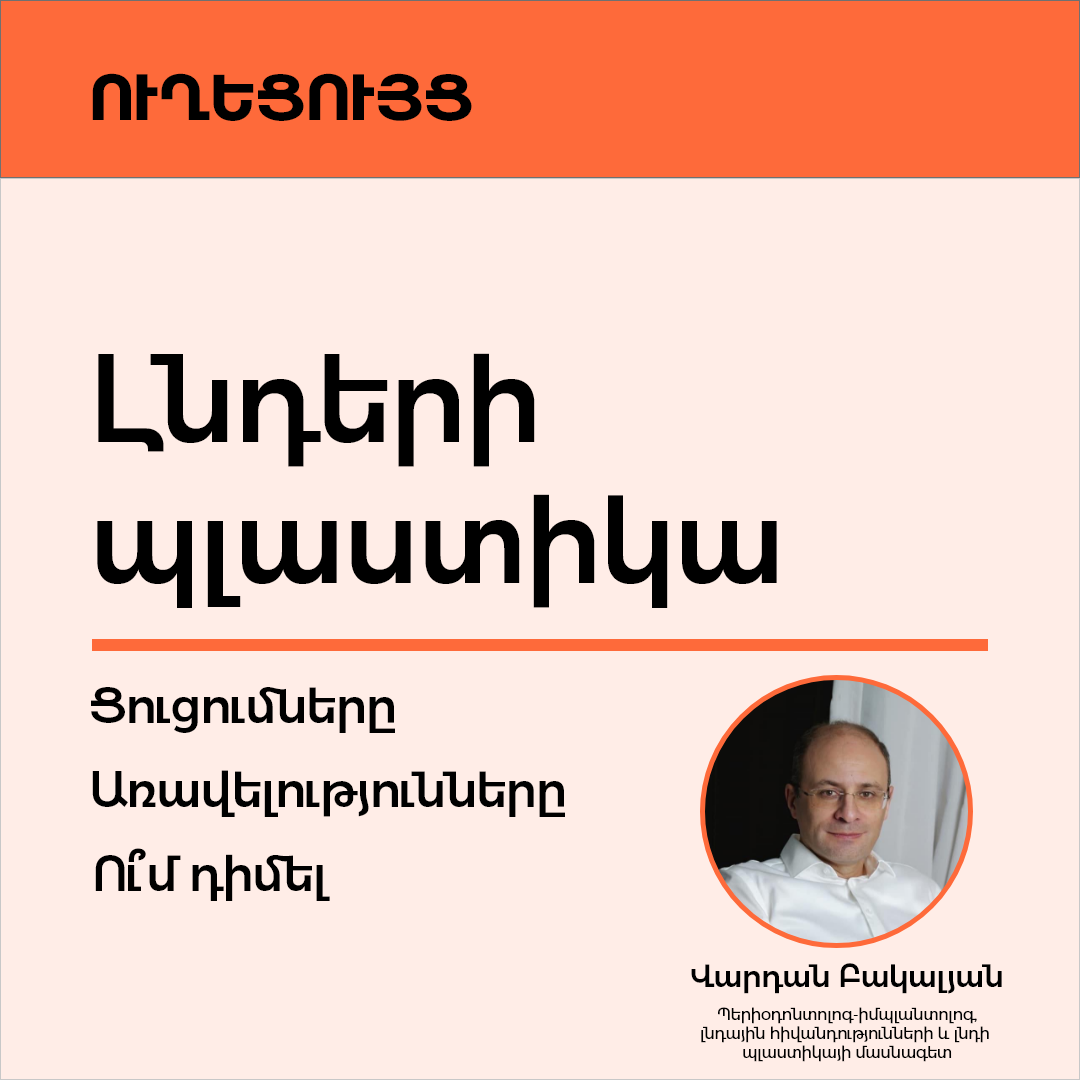 Լնդերի պլաստիկա - Doctor Yan Blog